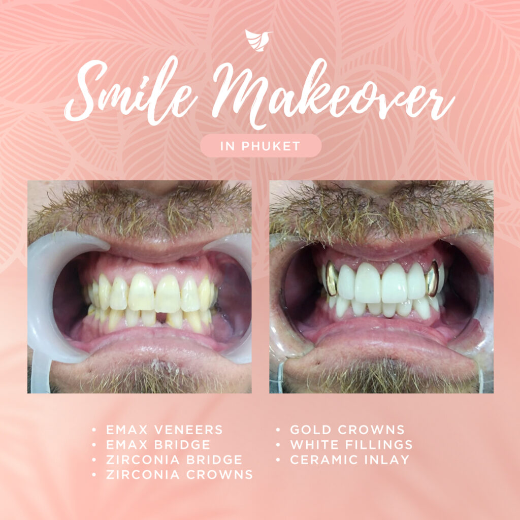 3184.RBG-BA - Restored Beauty Getaways